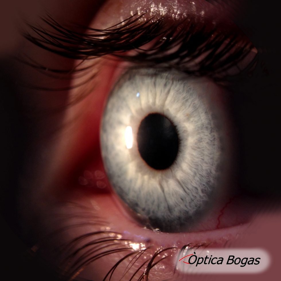 Biomicroscópia - Òptica Bogas